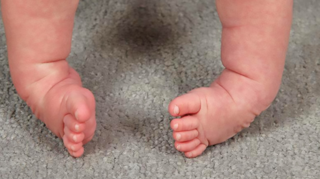 Çocuk Ayak Hastalıkları - Doç. Dr. Murat Kaya