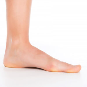 Z-Ayak (Skew Foot) - Doç. Dr. Murat Kaya